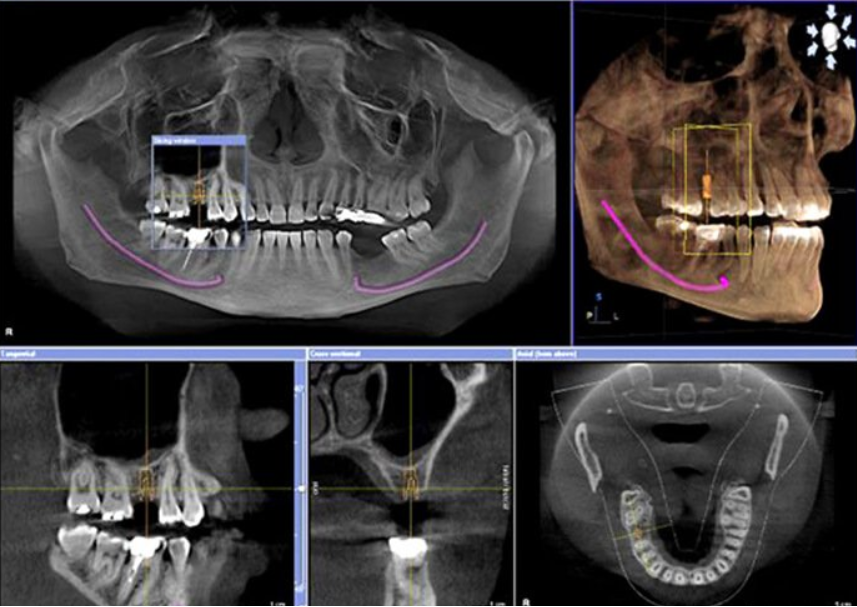 3D panorāmas rentgens tagad arī Rēzeknē - Komercinformācija - Rēzeknes ...